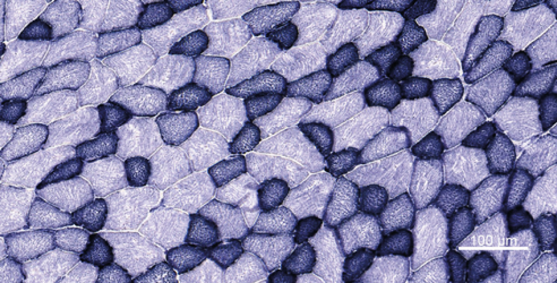 Aging muscles – uncovering the causes of sarcopenia | Swiss National ...