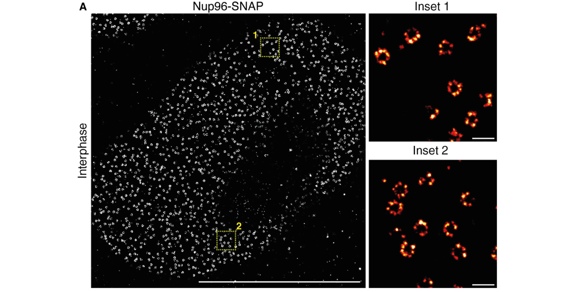 New Insights into NPC Disassembly during Mitosis | Swiss National ...